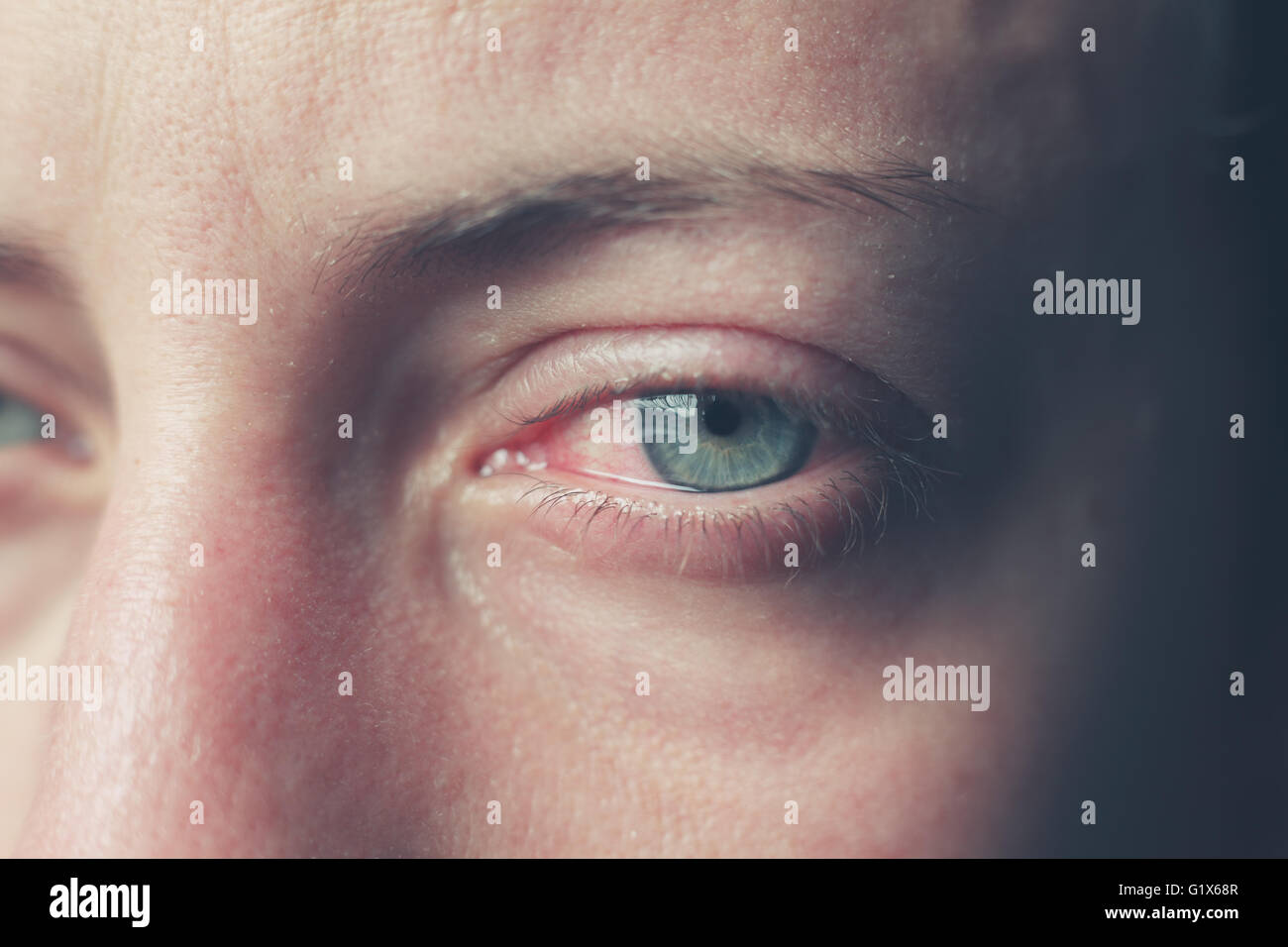 Yeux qui pleurent Banque de photographies et d’images à haute ...