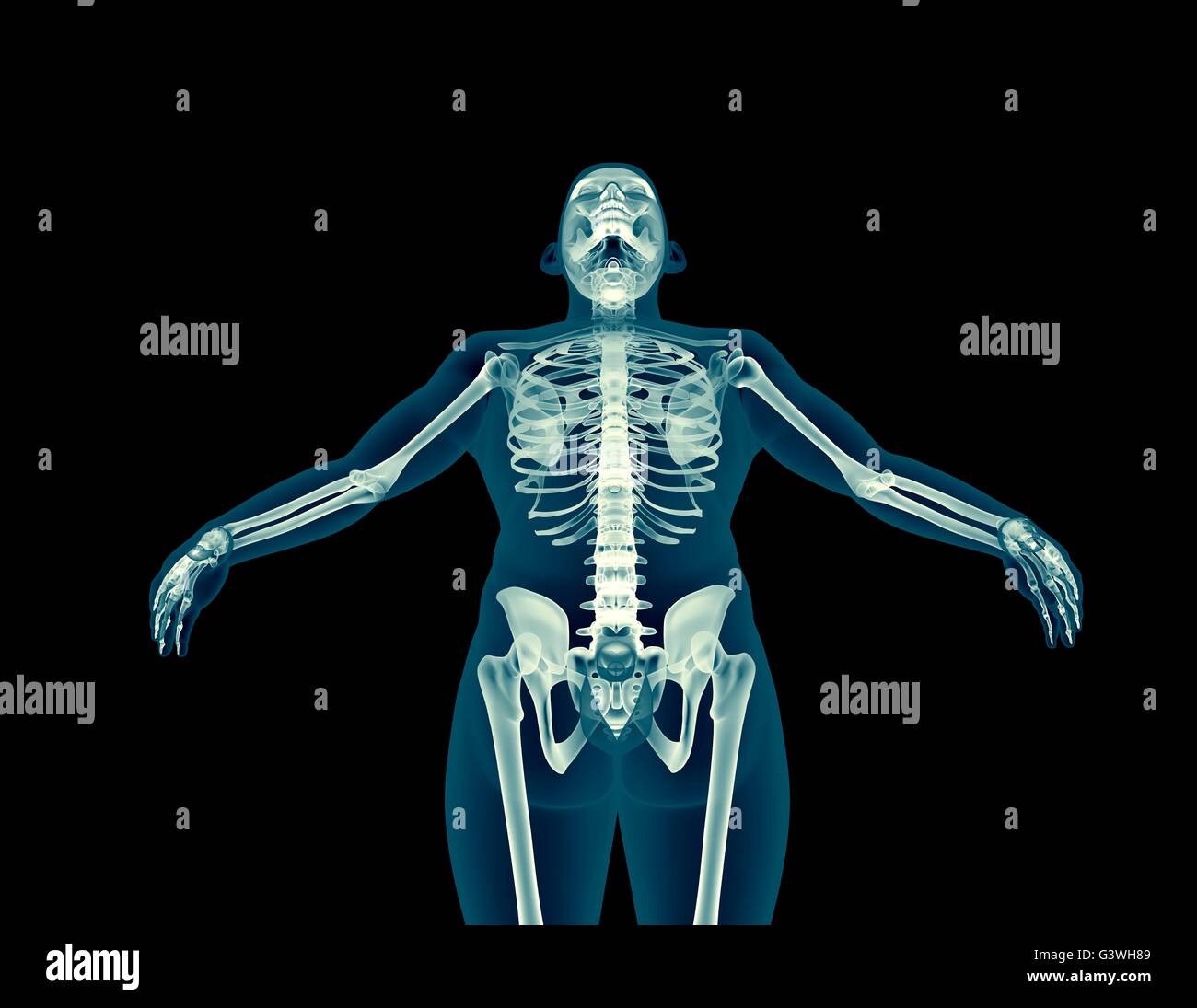 Radiografia de un cuerpo humano Banque de photographies et d’images à ...