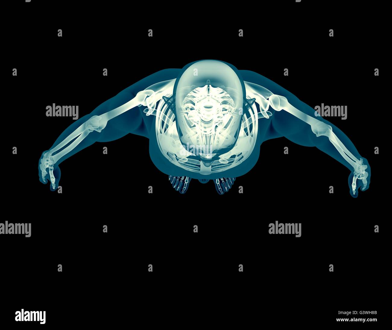 Radiografia de un cuerpo humano Banque de photographies et d’images à ...