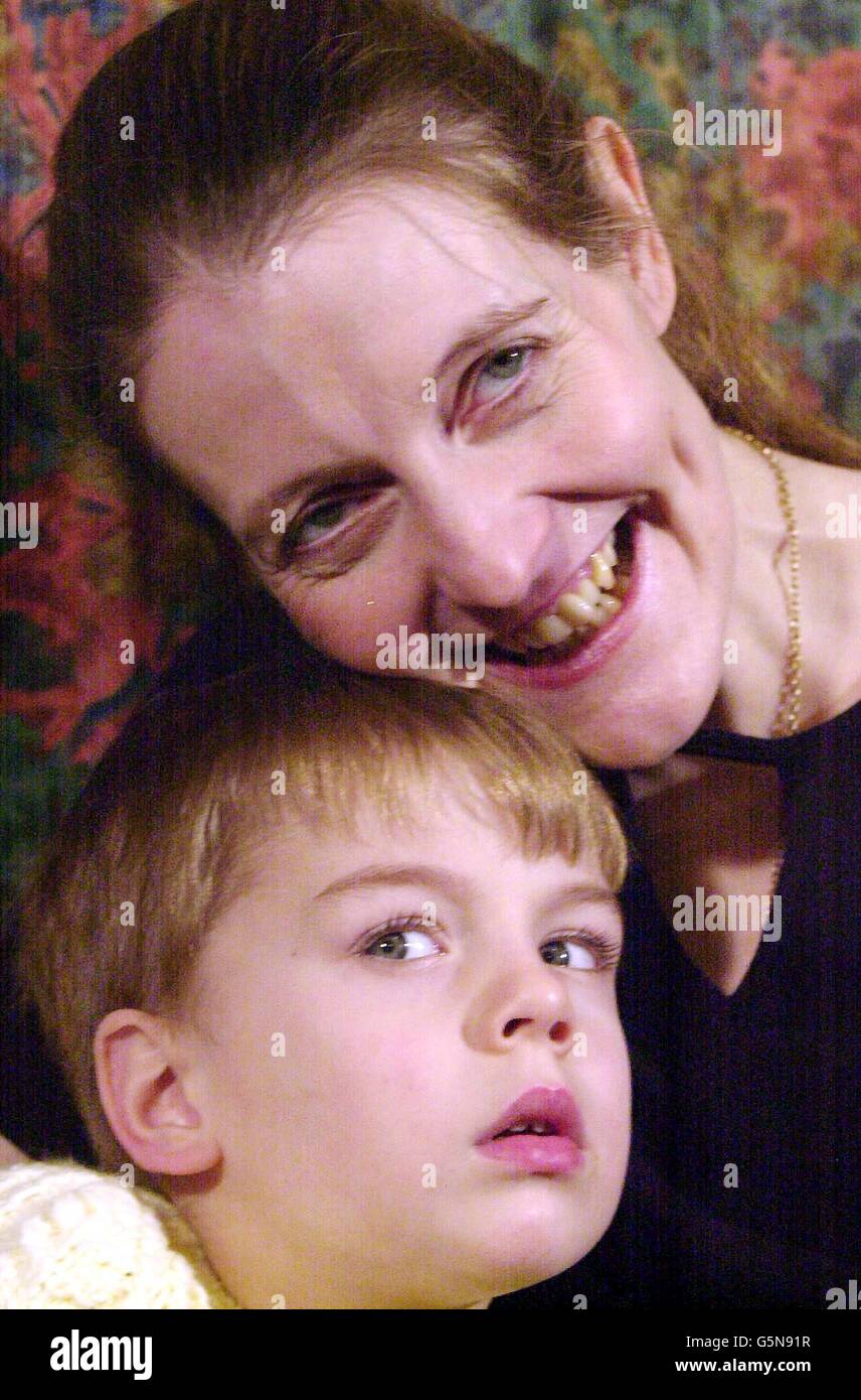 Grossesse sanguine diane Banque de photographies et d’images à haute ...