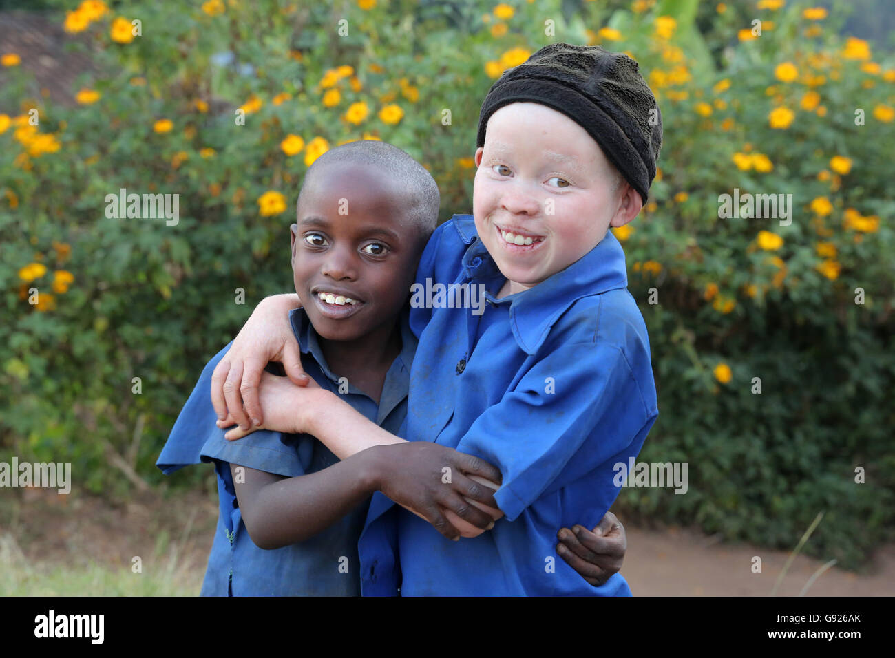 Fille albinos (12 ans, à droite) et un petit noir (8) dans un village ...