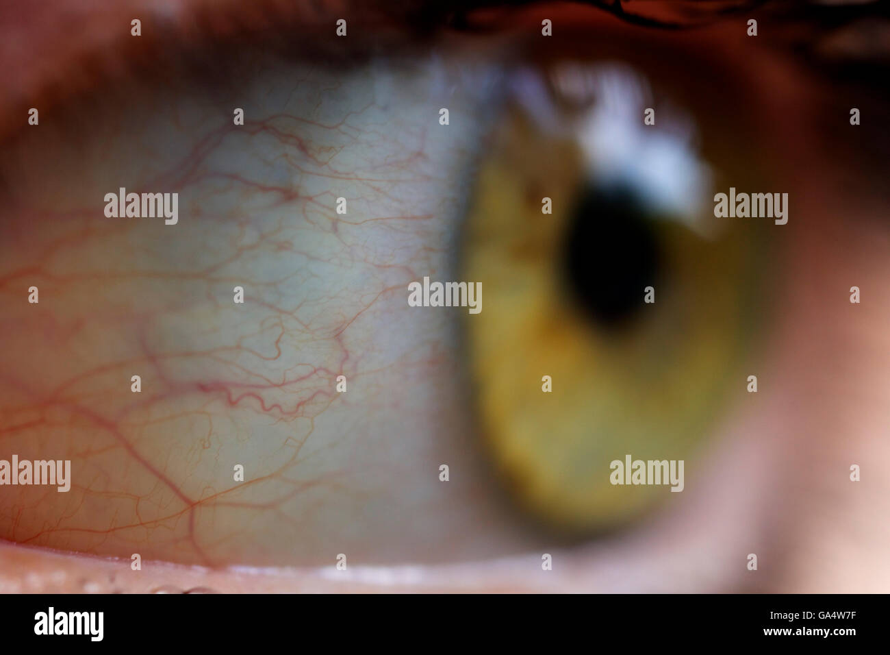 Eye veins Banque de photographies et d’images à haute résolution - Alamy