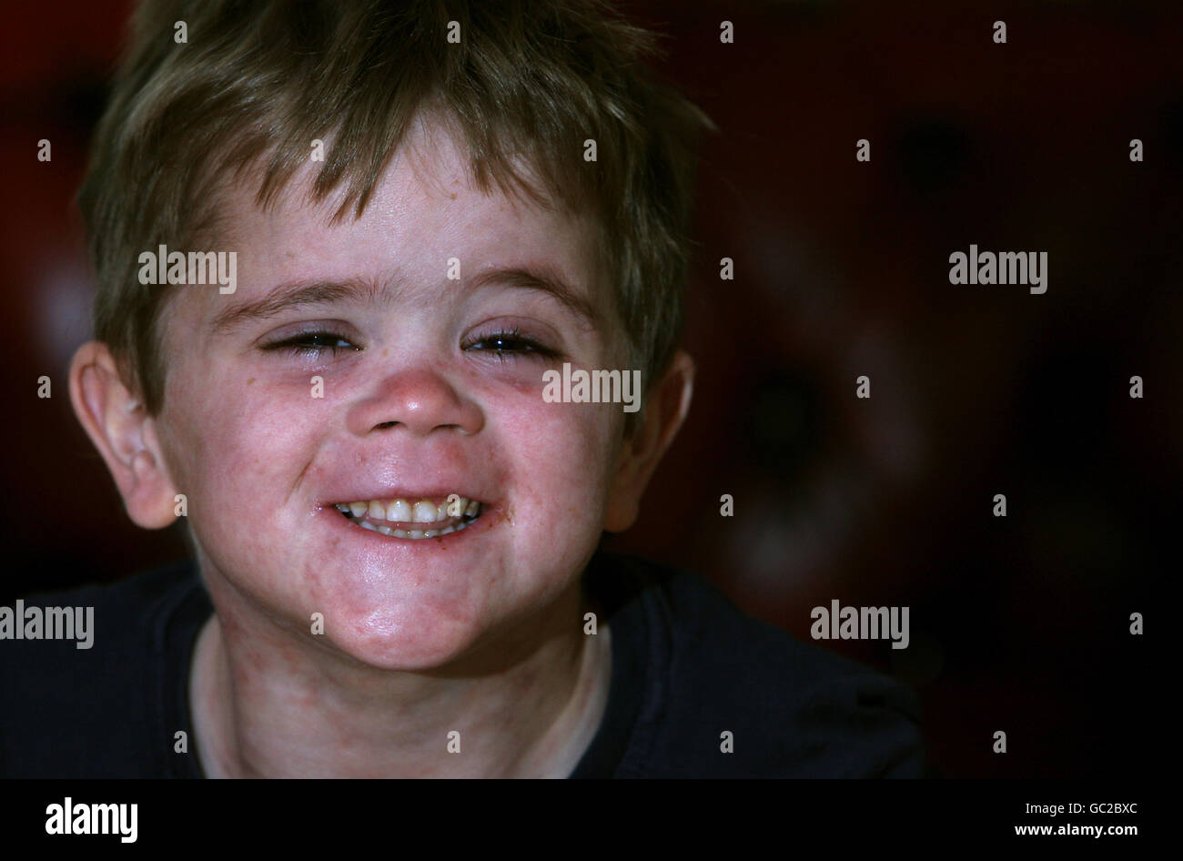 Jamie Reece, âgé de 5 ans, d'Easton, à Cambridgeshire, qui a reçu un ...