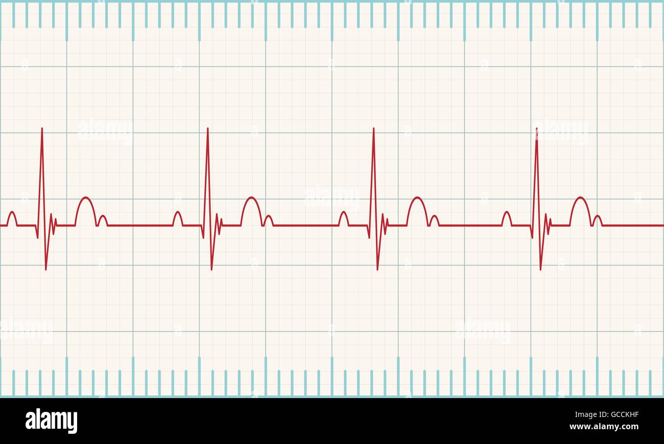 Moniteur cardiaque cardiogramme ekg Banque d'images vectorielles - Alamy
