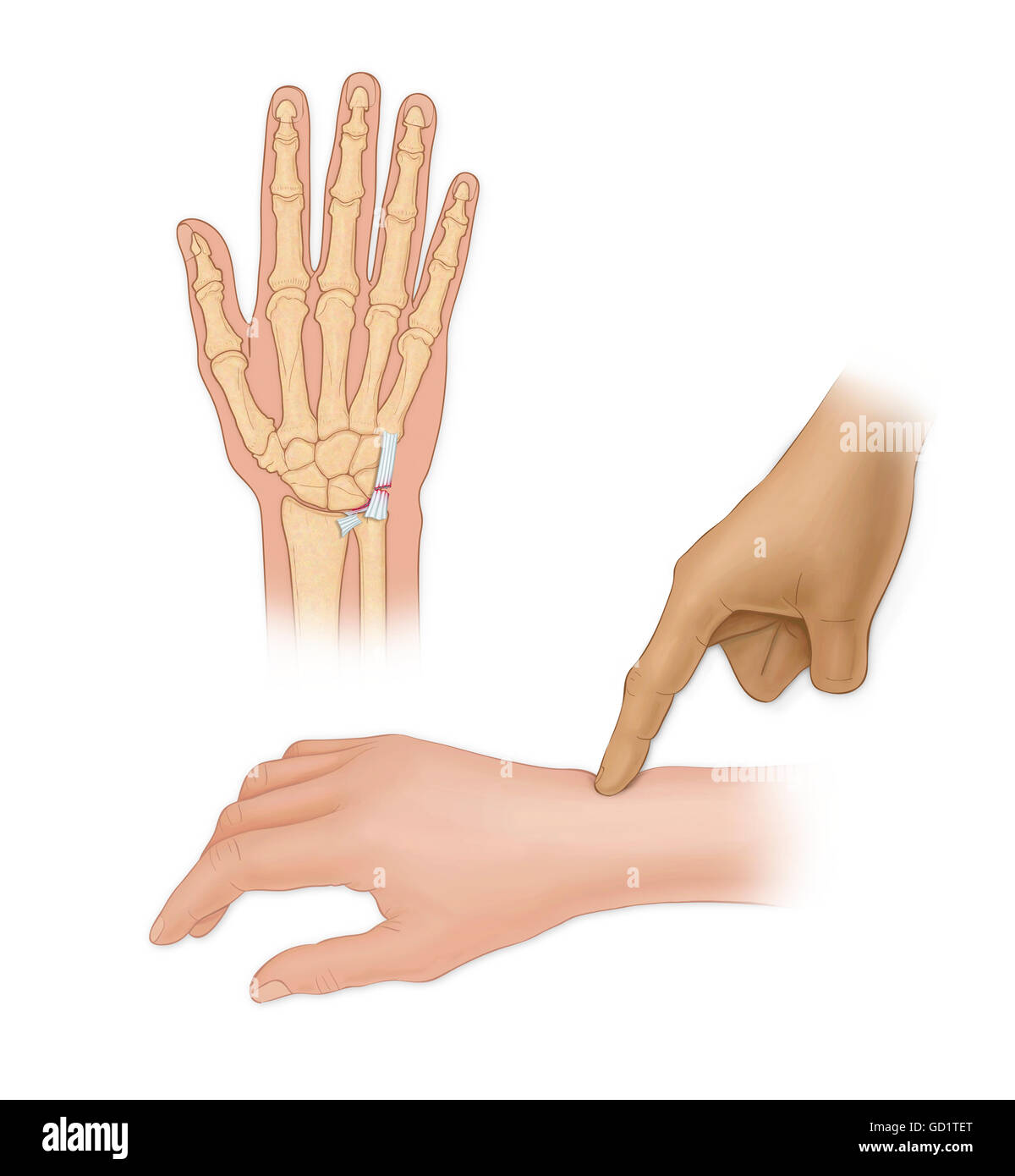 Les os de la main et pointer du doigt les blessures au poignet Photo ...