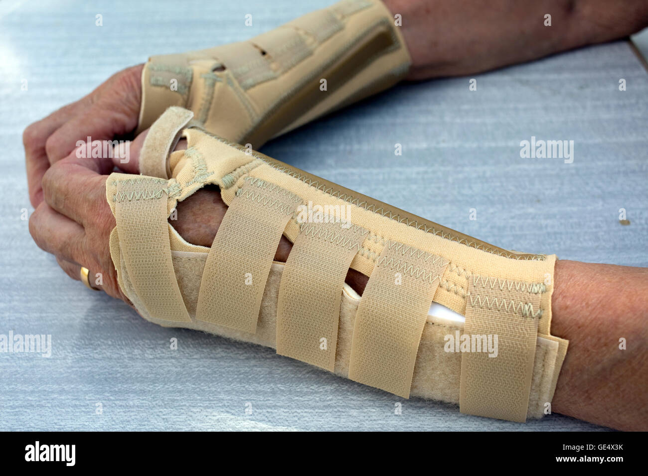 Arthrose du poignet Banque de photographies et d’images à haute ...