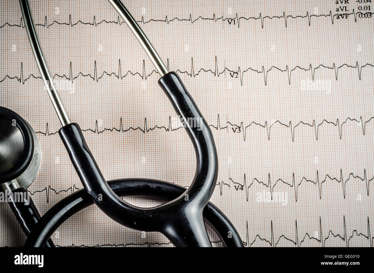 Examen du rythme cardiaque Banque de photographies et d’images à haute ...