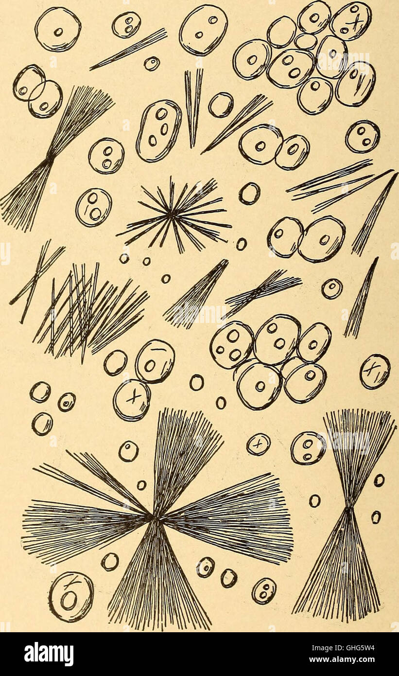 L'analyse urinaire et le diagnostic par examen microscopique et ...