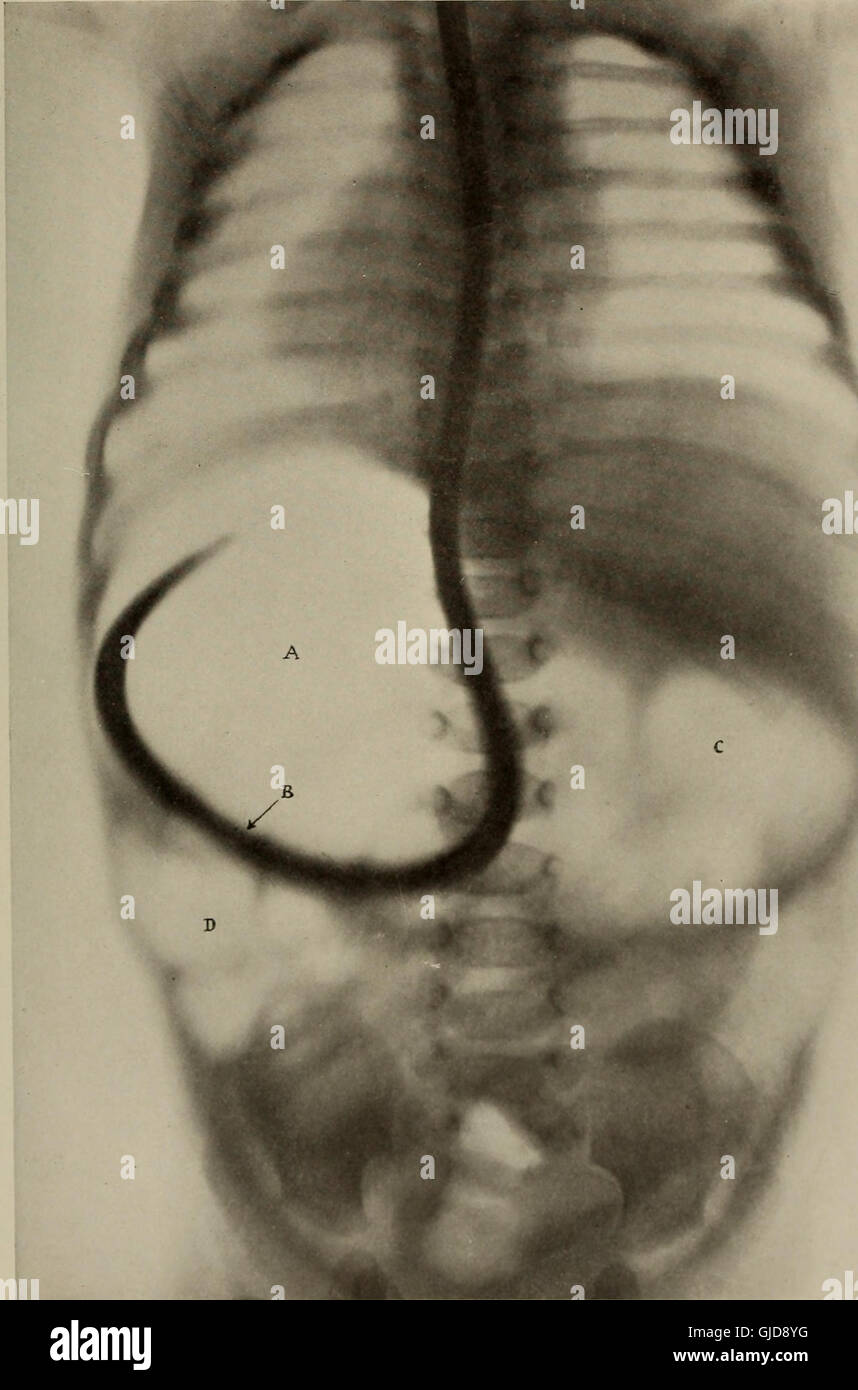 'Living Anatomy and Pathology' (1910) fournit une étude approfondie du corps humain, en se ...