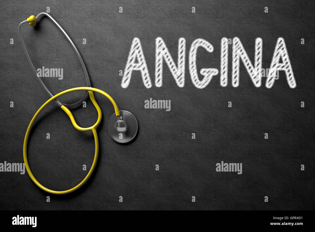 Angina pectoris Banque de photographies et d’images à haute résolution ...