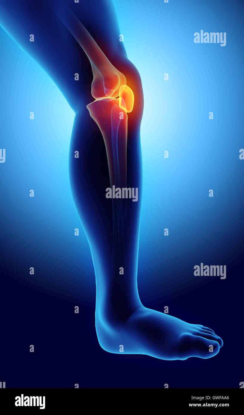 Knee osteoarthritis 3d scan Banque de photographies et d’images à haute ...
