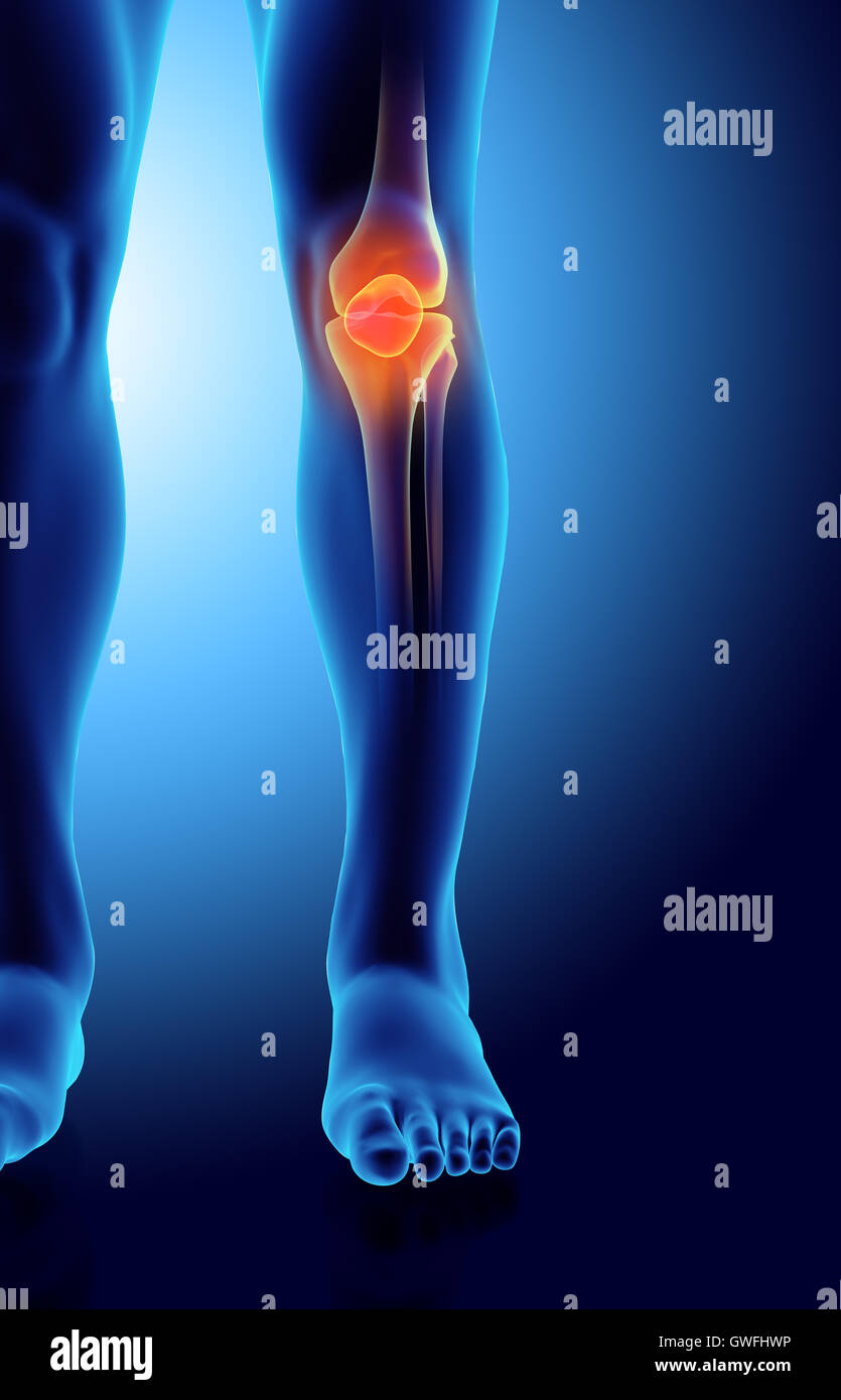 Knee osteoarthritis 3d scan Banque de photographies et d’images à haute ...