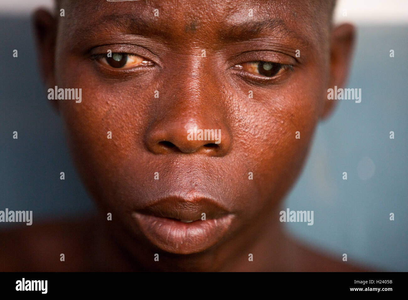 Cataracte femme africaine Banque de photographies et d’images à haute ...