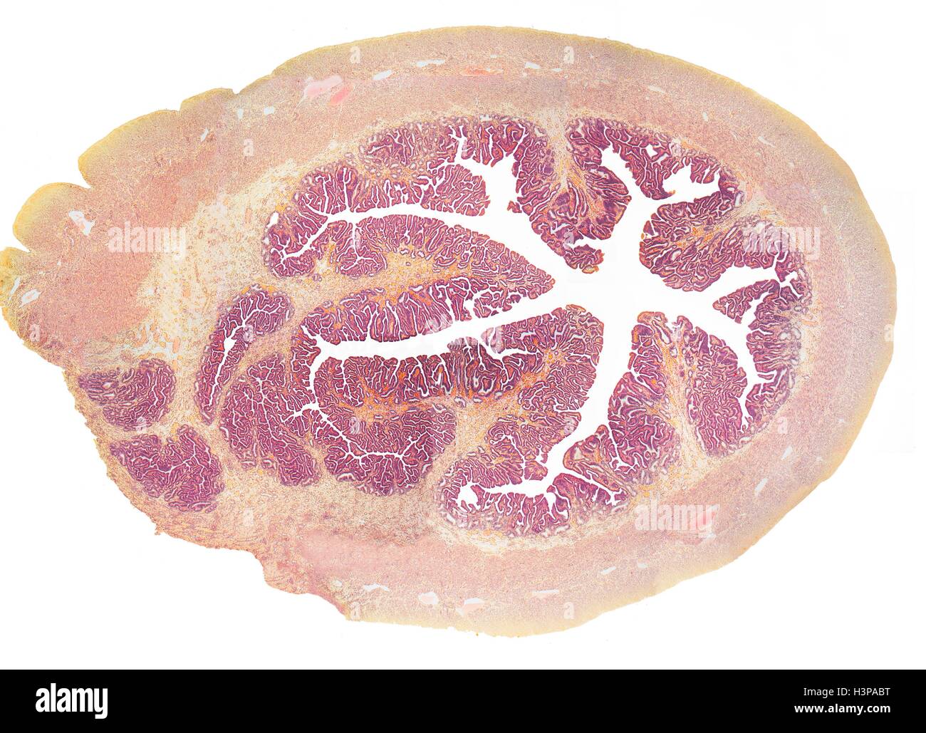 Fallopian Tubes Photos & Fallopian Tubes Images - Alamy