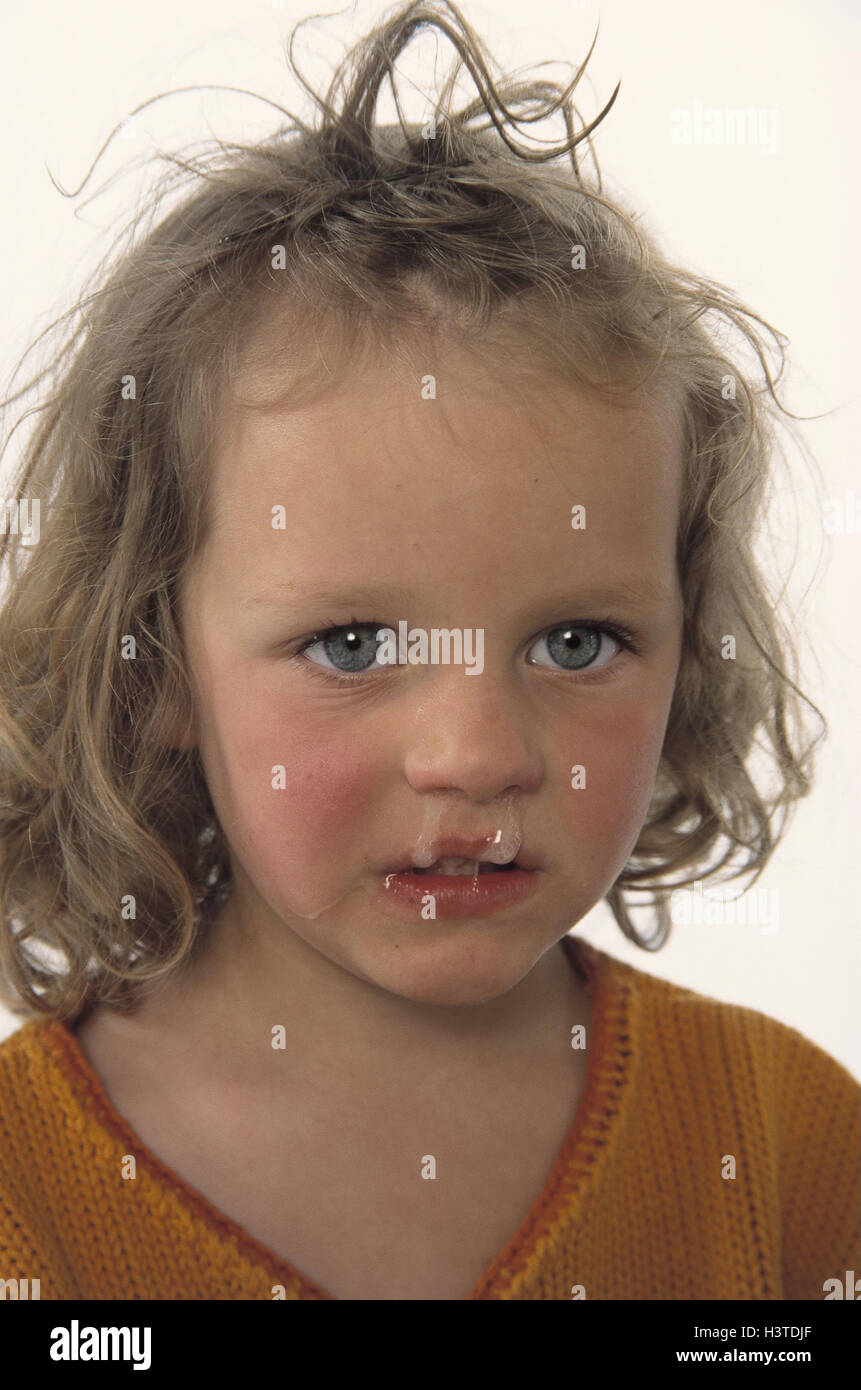Les filles, le coryza, la morve du nez, portrait, enfants, coryza, avec ...