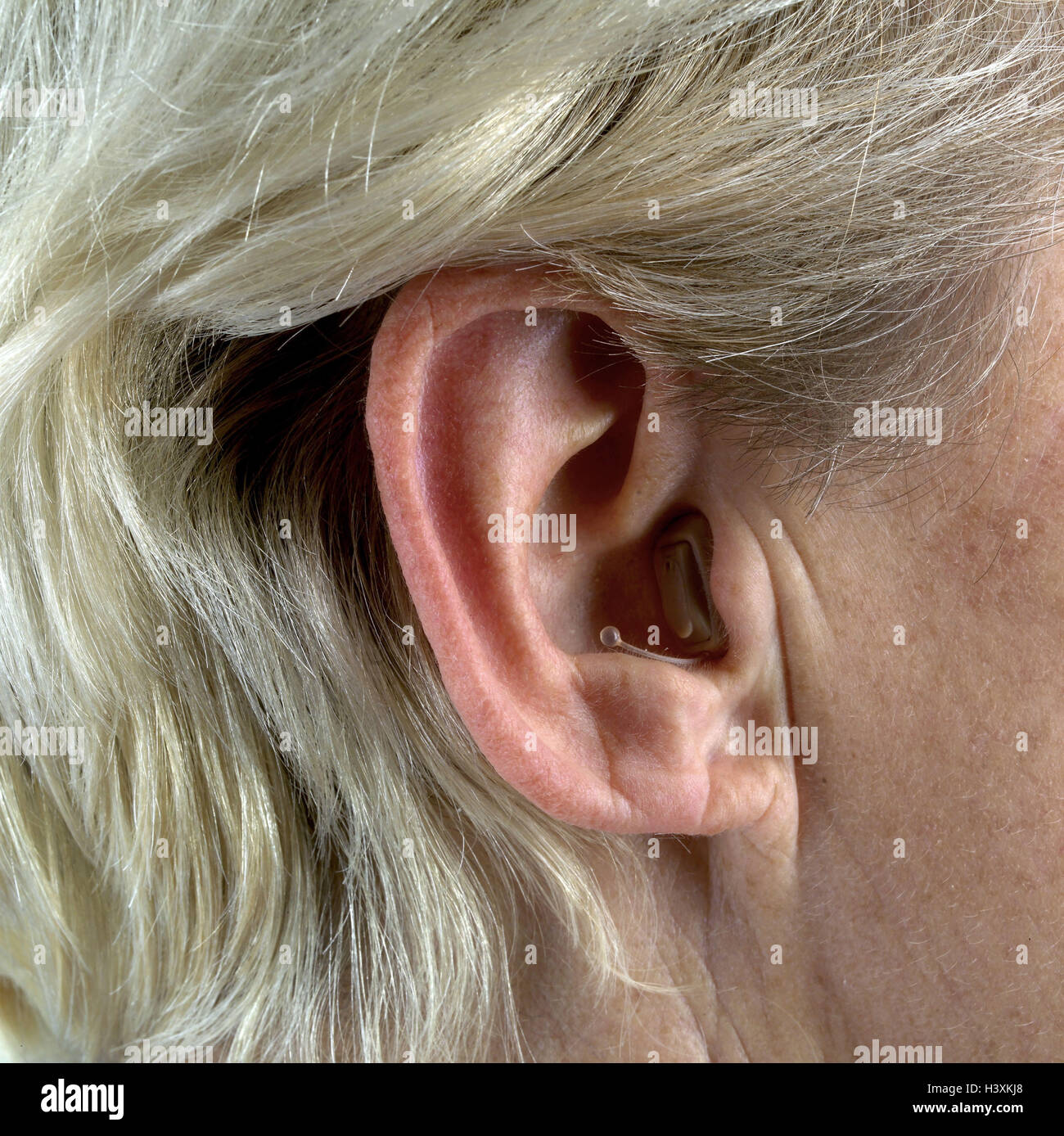 Maladie de l'oreille Banque de photographies et d’images à haute ...