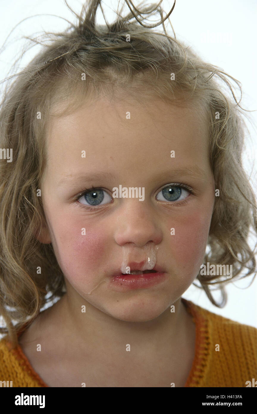 Les filles, le coryza, la morve du nez, portrait, enfants, coryza, avec ...