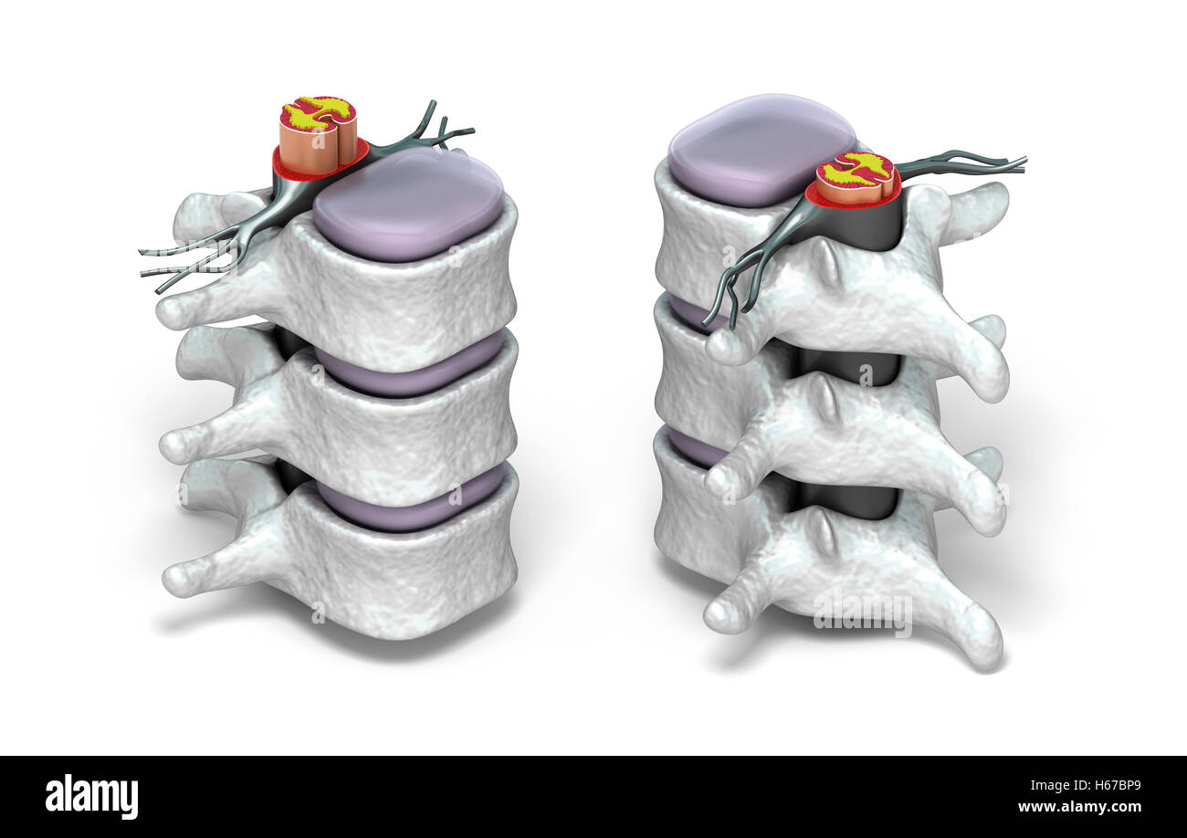 Colonne vertébrale humaine en détails : des vertèbres, la moelle ...