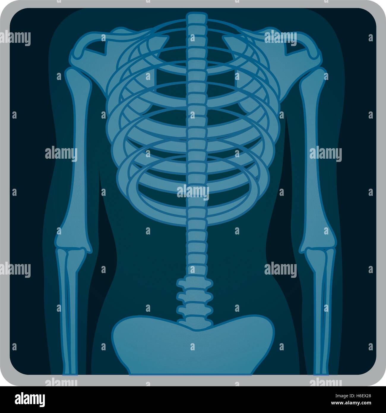 Radiographie thoracique Banque d'images vectorielles - Alamy