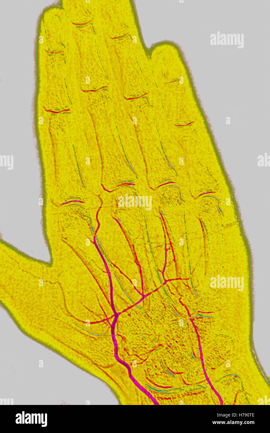 Vaisseaux sanguins de la main Banque de photographies et d’images à ...