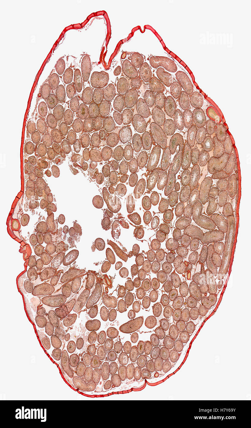 Détail microscopique montrant une section transversale d'un testicule ...