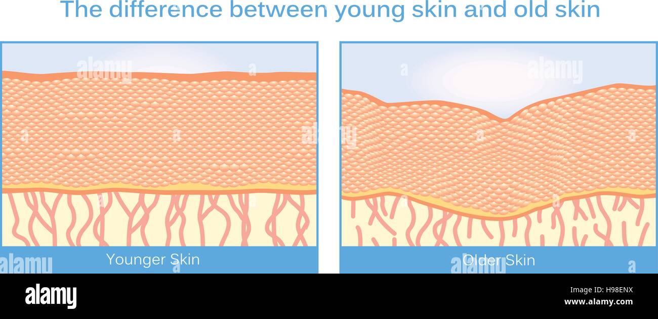 La différence entre la peau jeune et vieille peau Image Vectorielle Stock - Alamy