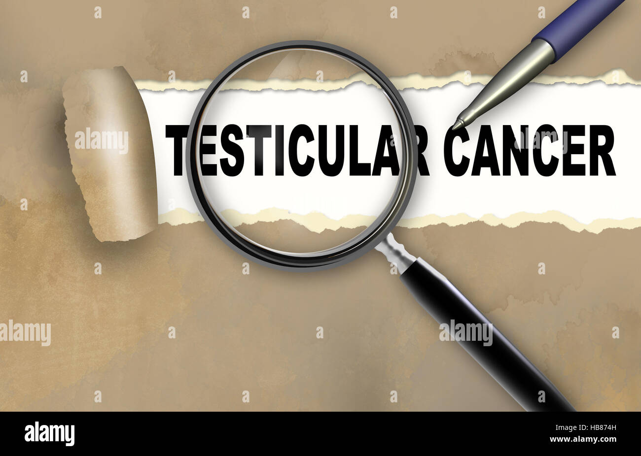 Le cancer du testicule Photo Stock - Alamy
