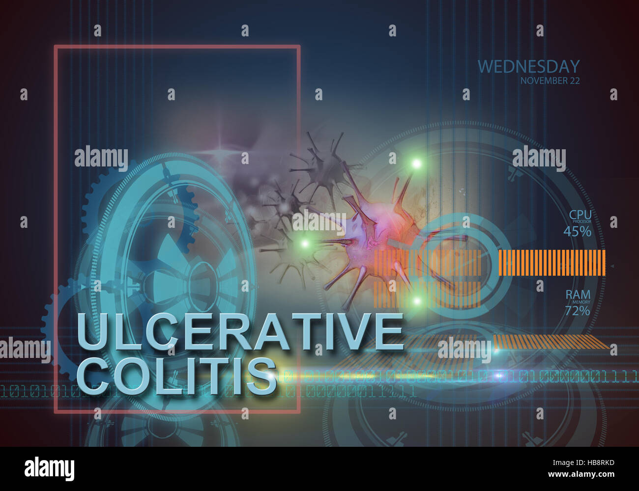 Rectocolite hemorragique Banque de photographies et d’images à haute ...