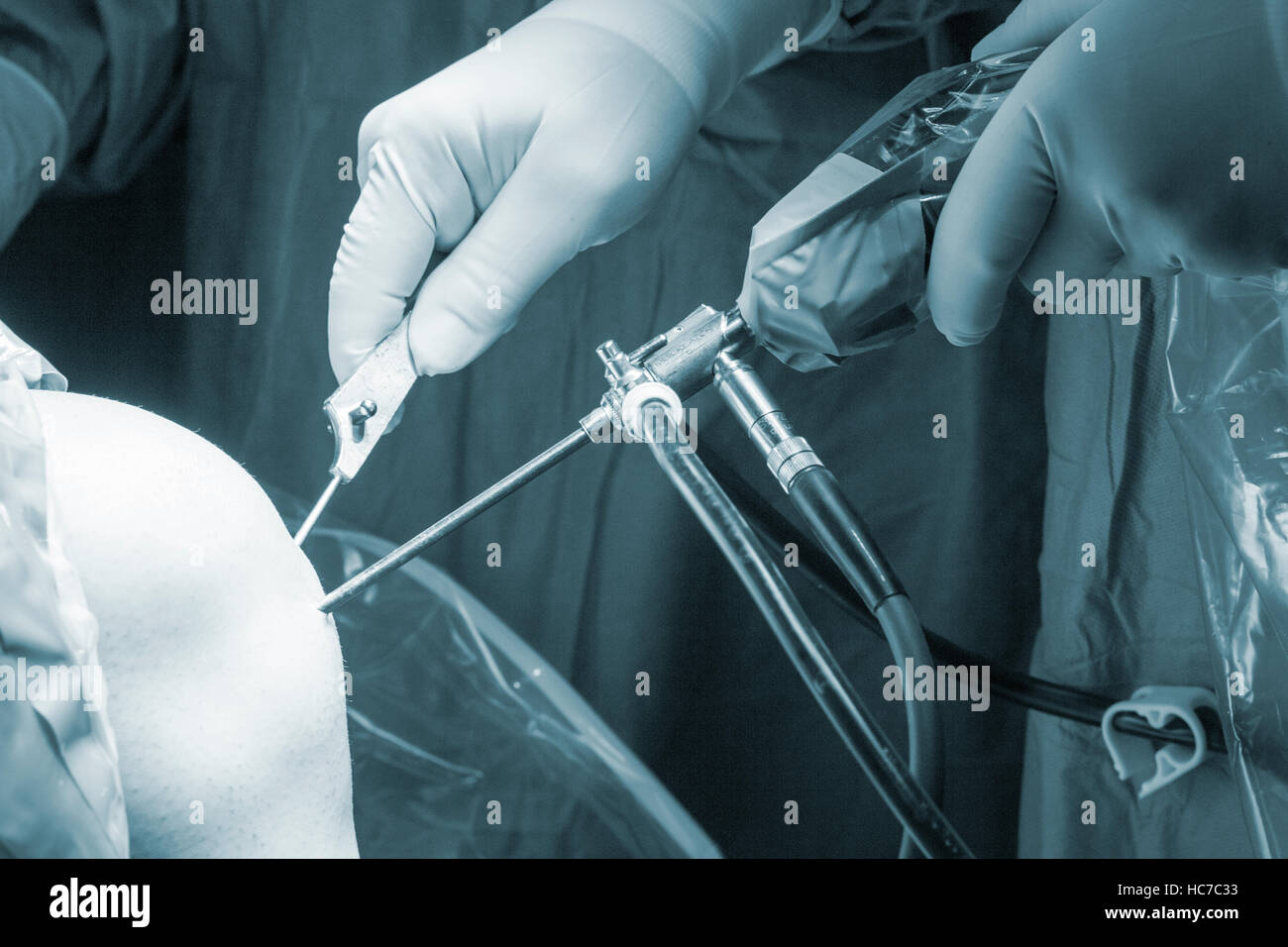 Opération chirurgicale pour l'arthroscopie du genou chirurgie micro à l ...