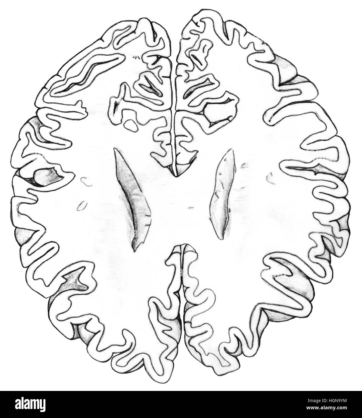 Coupe sagittale du cerveau humain Banque de photographies et d’images à ...