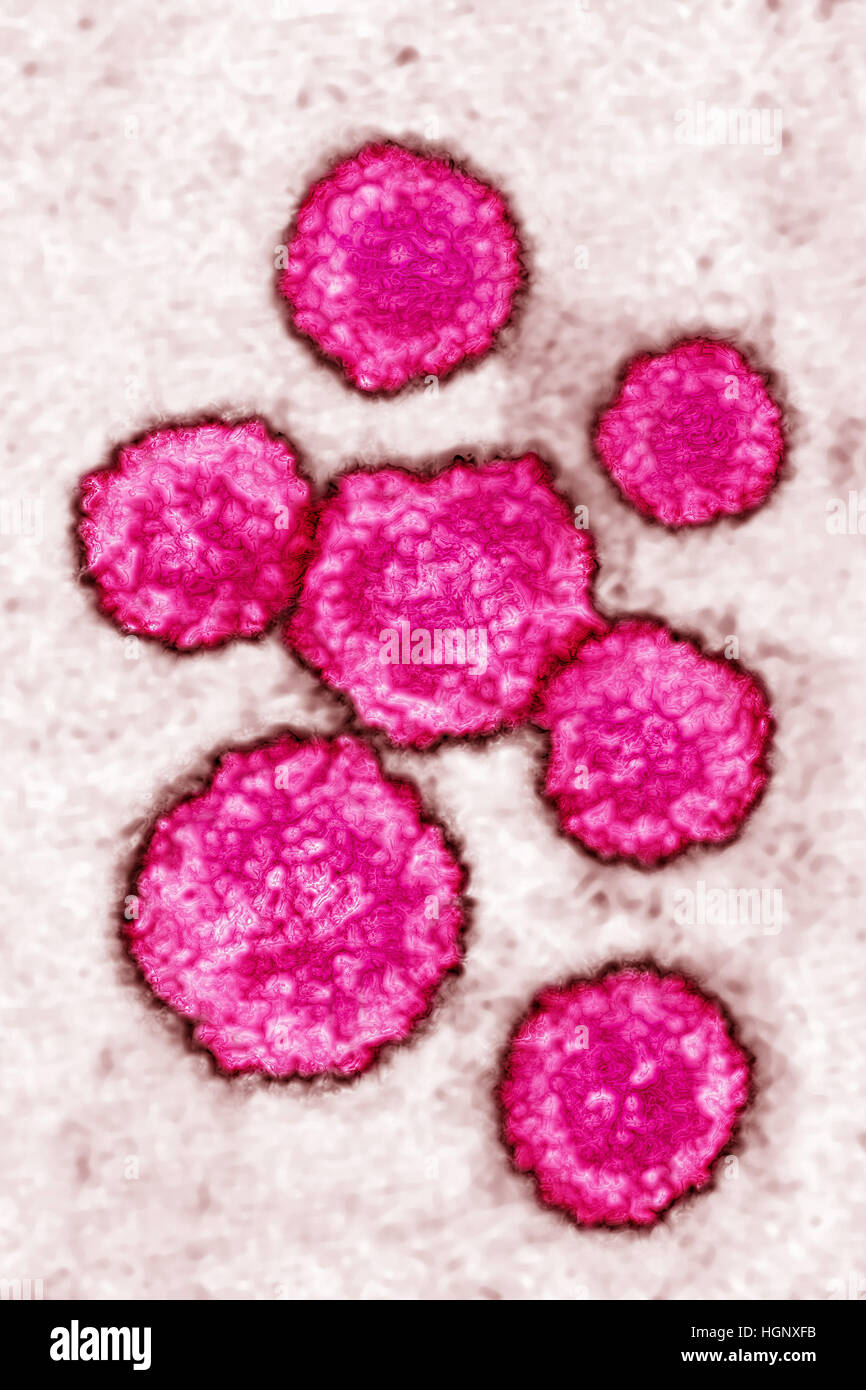 Virus de la rubéole Banque de photographies et d’images à haute ...