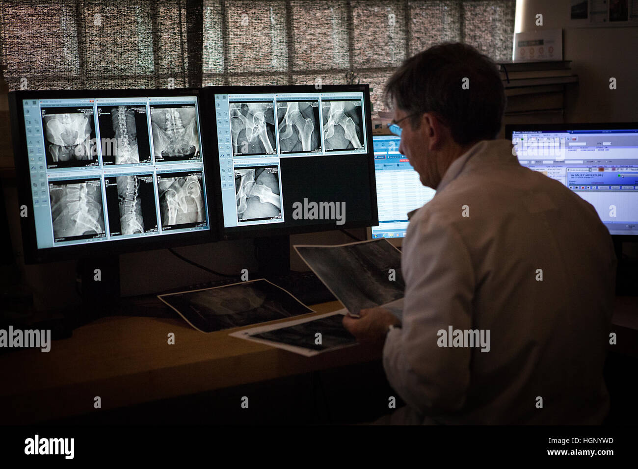 Radiologie Diagnostique Banque d'image et photos - Alamy