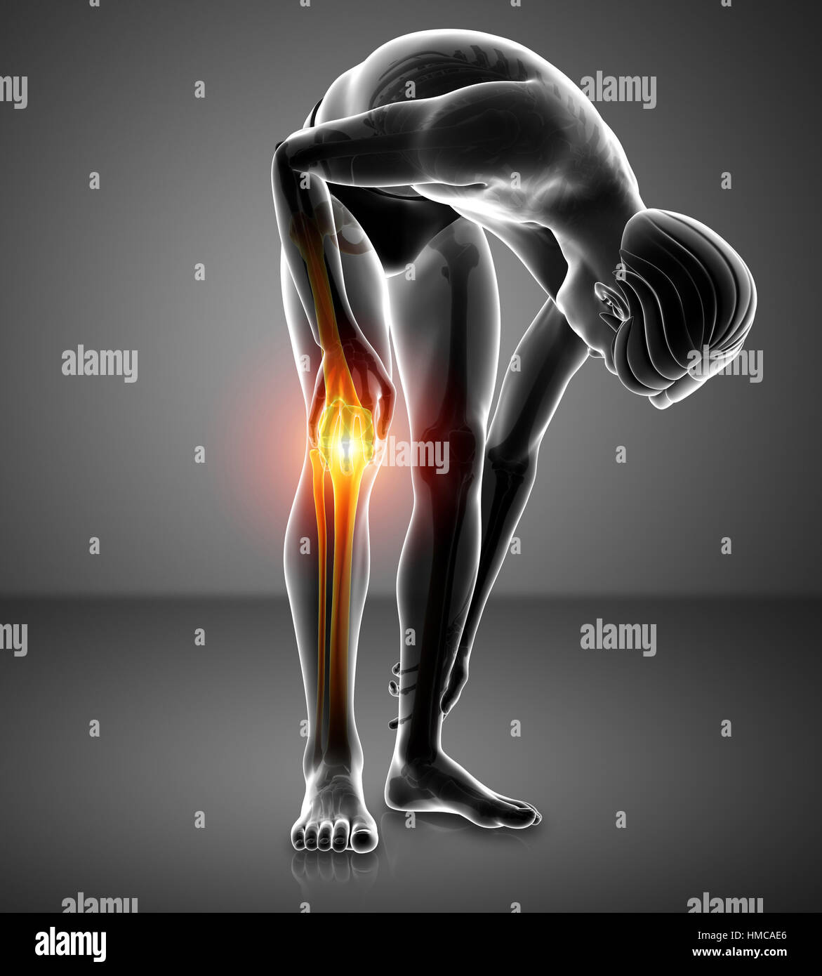 L'anatomie du corps humain avec douleur commune Photo Stock - Alamy