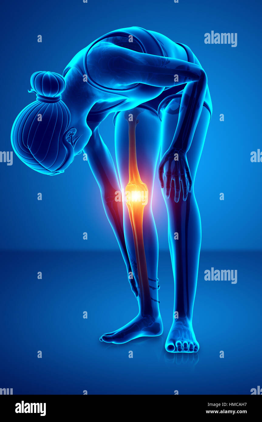 L'anatomie du corps humain avec douleur commune Photo Stock - Alamy