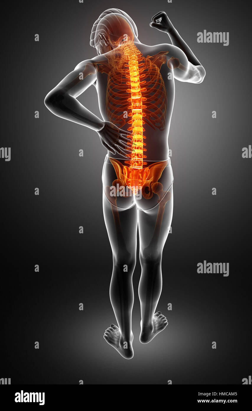 L'anatomie du corps humain avec douleur commune Photo Stock - Alamy