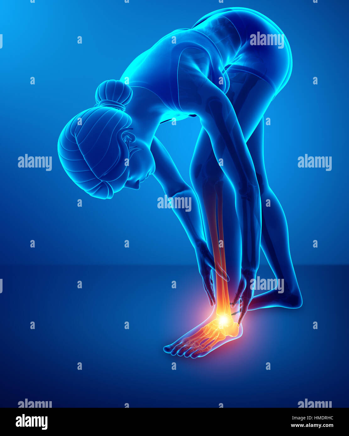 L'anatomie du corps humain avec douleur commune Photo Stock - Alamy