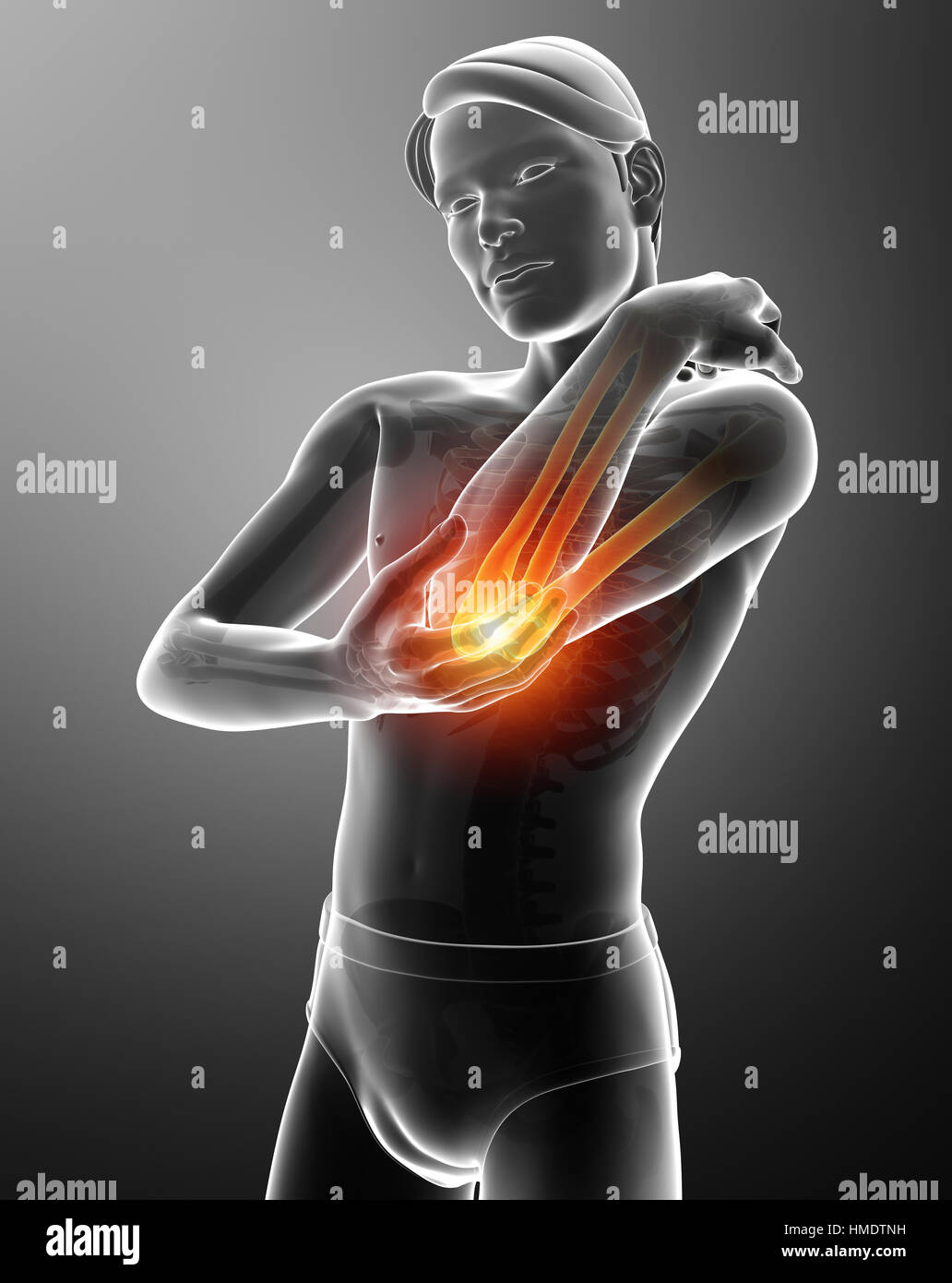 L'anatomie du corps humain avec douleur commune Photo Stock - Alamy