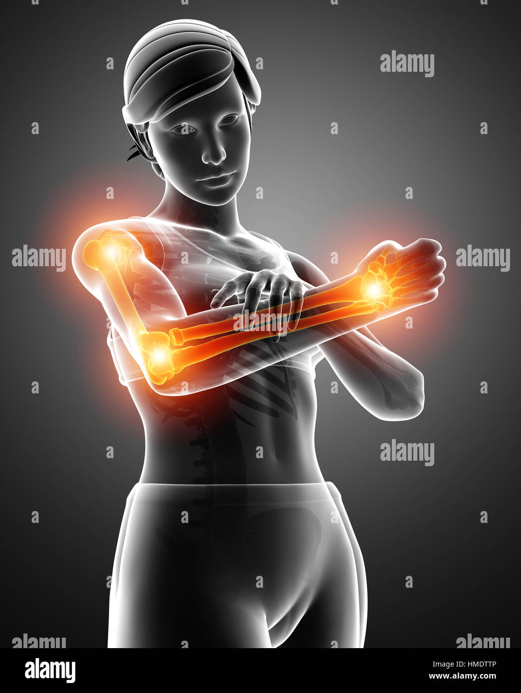 L'anatomie du corps humain avec douleur commune Photo Stock - Alamy