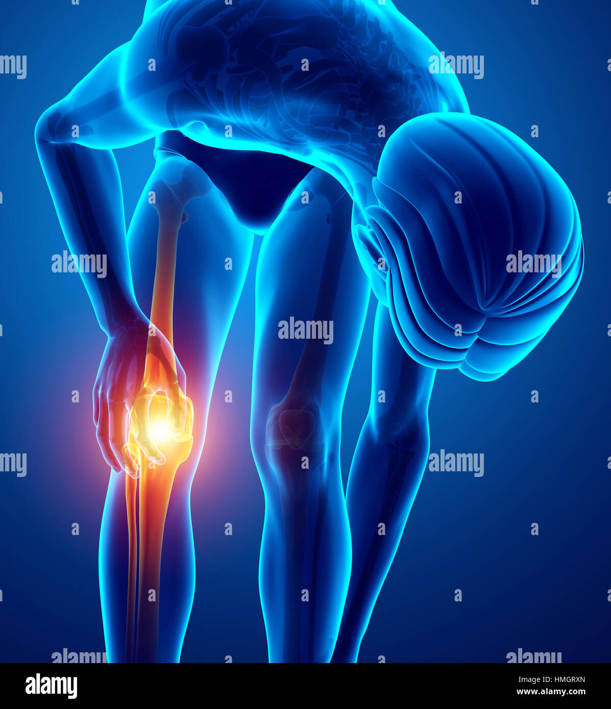 L'anatomie du corps humain avec douleur commune Photo Stock - Alamy