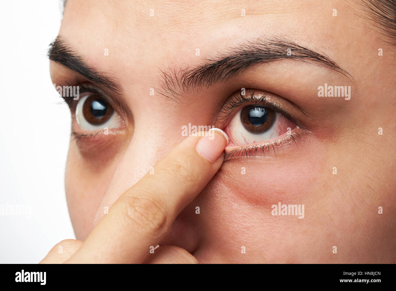 Oeil qui pleure Banque de photographies et d’images à haute résolution ...