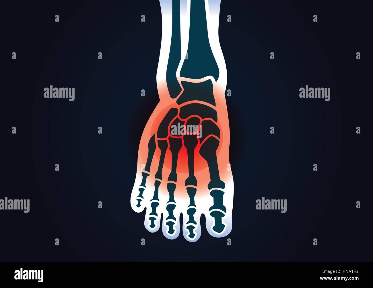 L'os du pied humain ont un signal rouge. Cette illustration à propos de ...