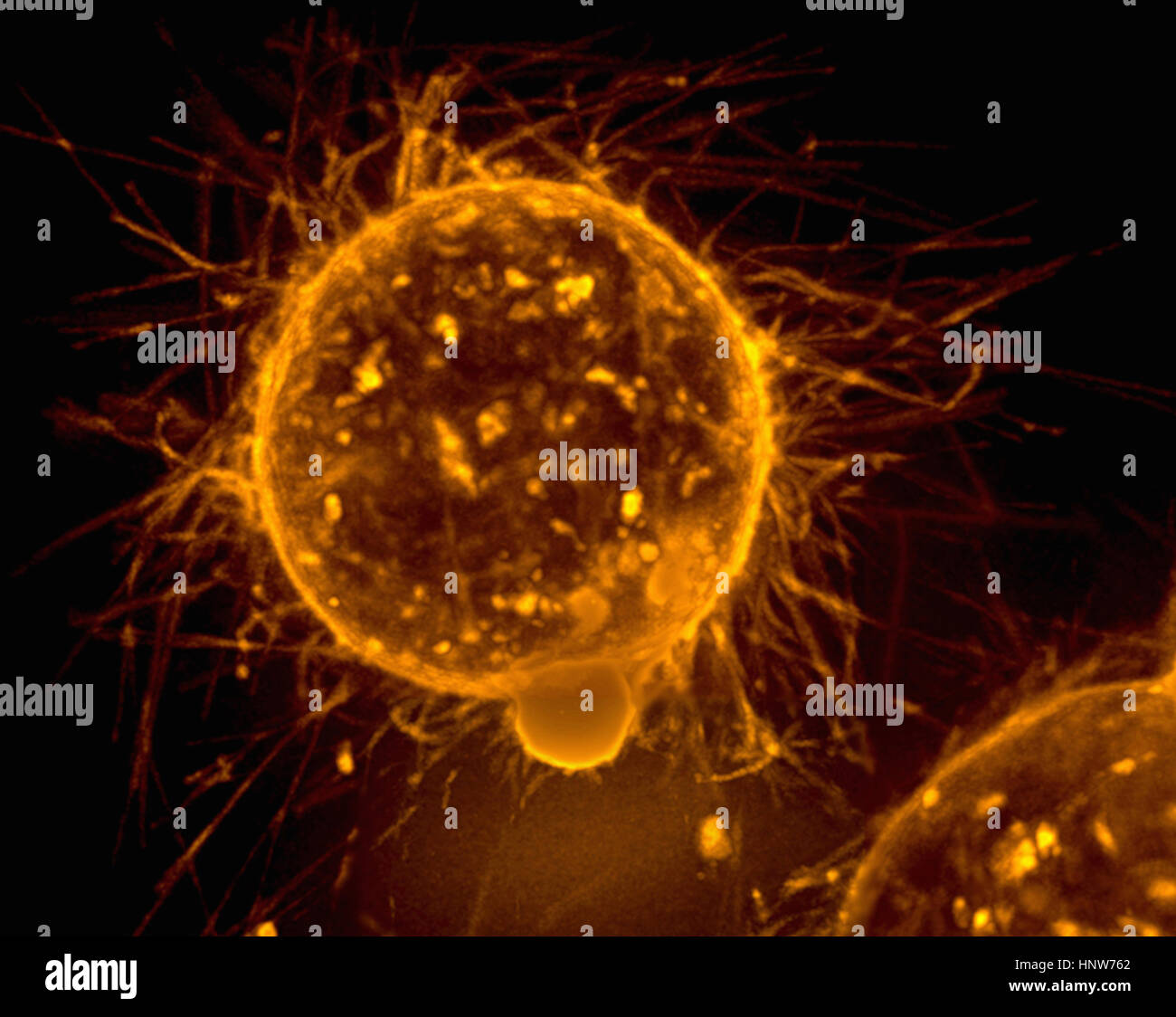 Microscopie à épifluorescence d microtentacles sur la surface de ...