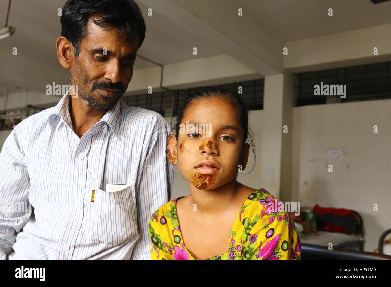 Tree man syndrome Banque de photographies et d’images à haute ...