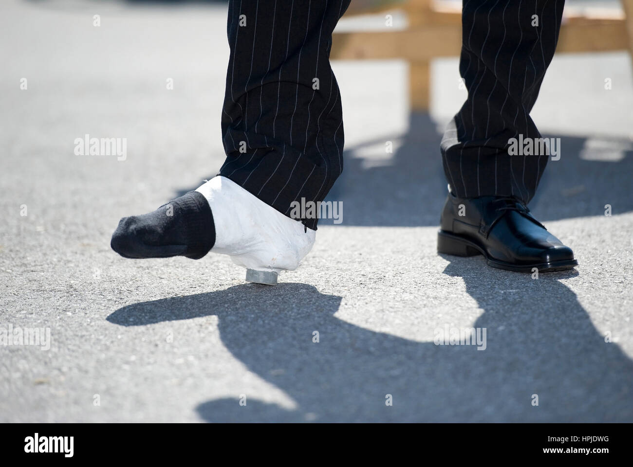 - Gipsbein jambe dans le plâtre Photo Stock - Alamy