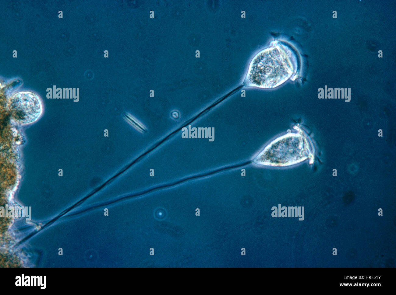 Vorticella sp Banque de photographies et d’images à haute résolution ...