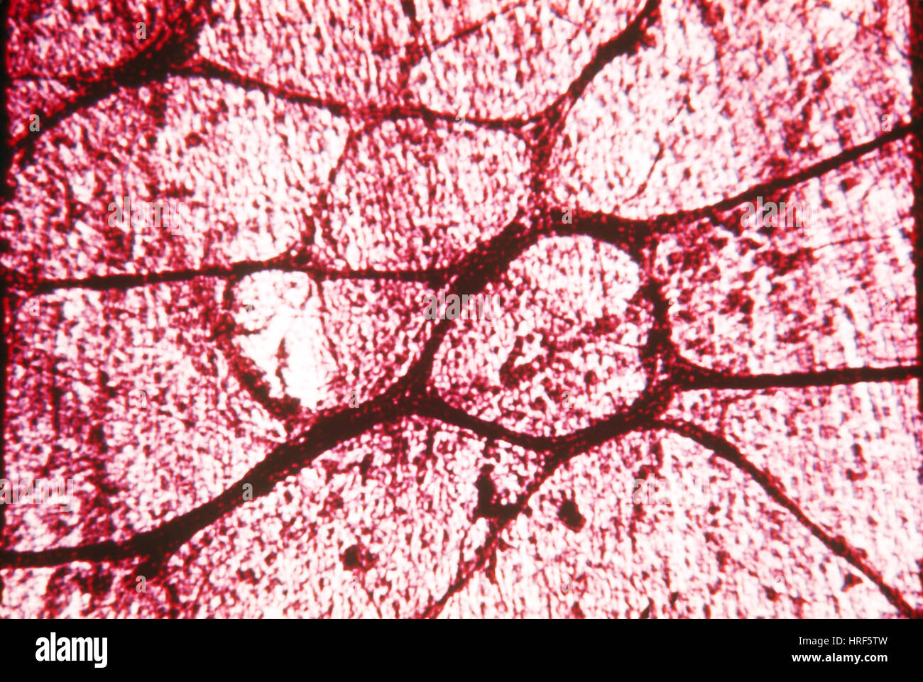 Plexus nerveux Banque de photographies et d’images à haute résolution ...