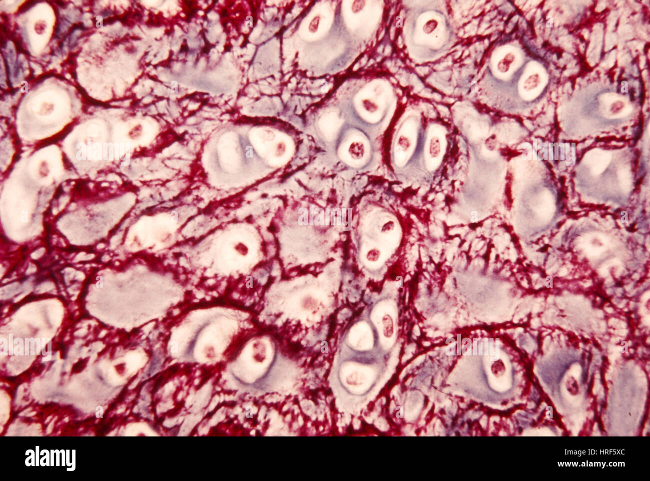 Matrice de cartilage Banque de photographies et d’images à haute ...