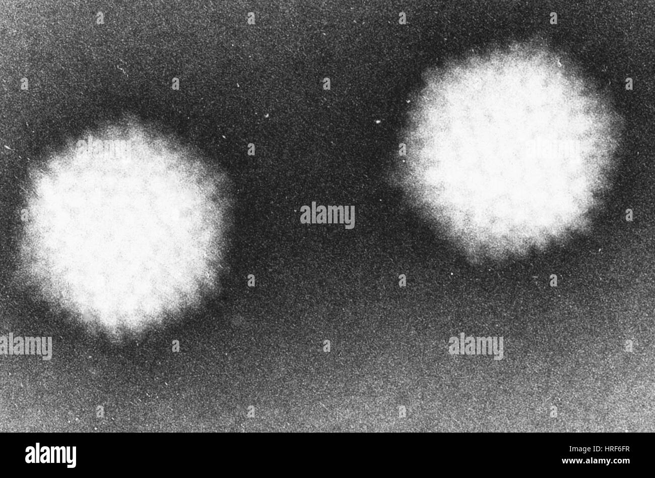 Transmission electron microscopy tem white Banque de photographies et d ...