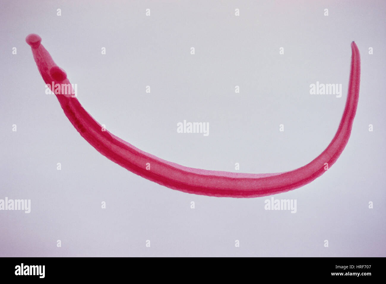 Schistosoma japonicum Banque de photographies et d’images à haute ...