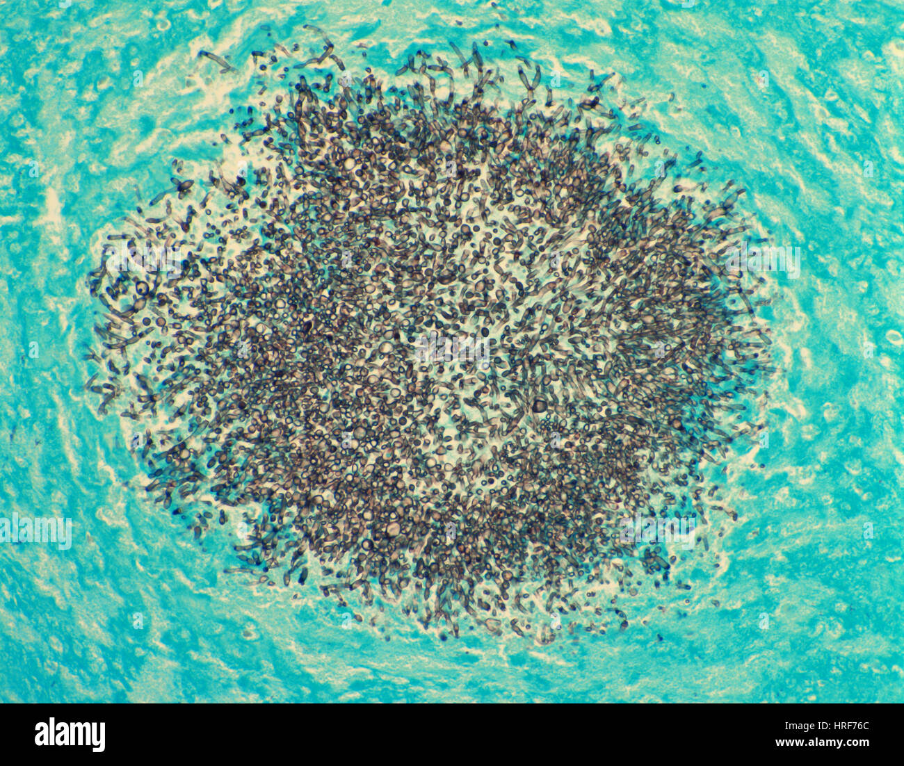 Candida albicans Banque de photographies et d’images à haute résolution ...